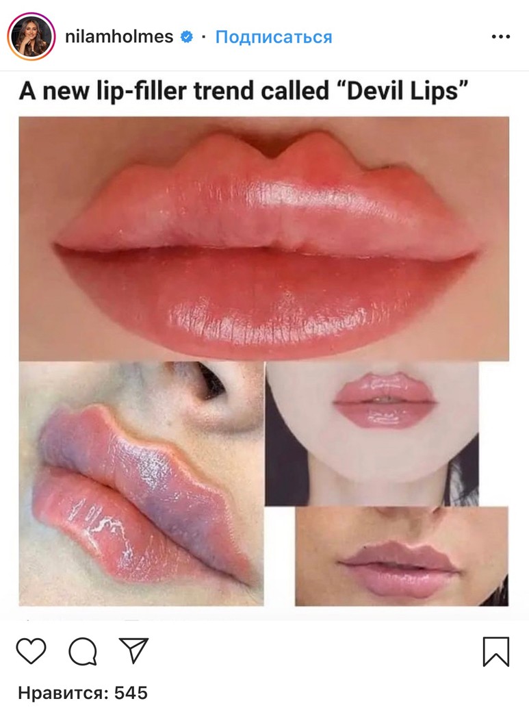 Instagram - lips (3) – Детали